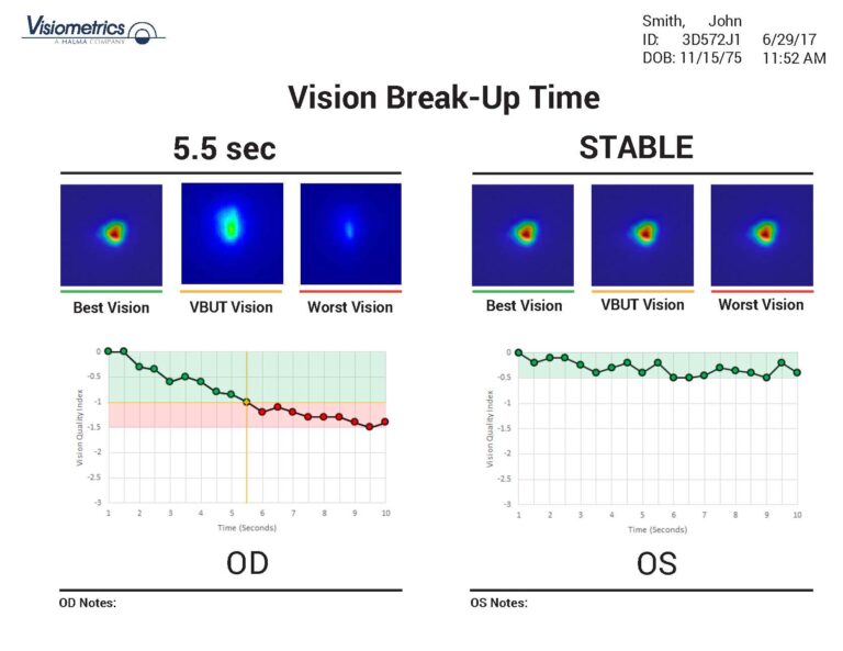 Ophthalmic Equipment - Hong Kong Bright Vision Eye Centre ...